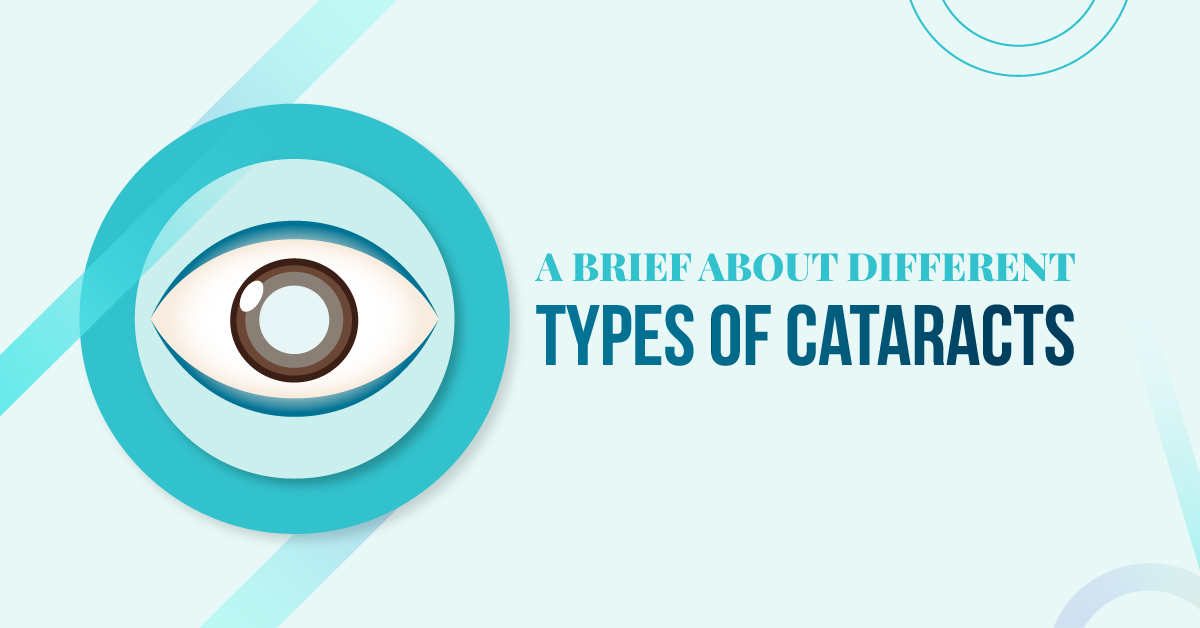 A brief about different types of Cataracts - Global Eye Hospital