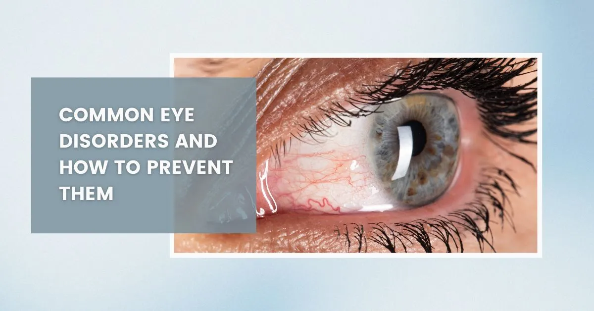 Common Eye Disorders and Prevention Tips